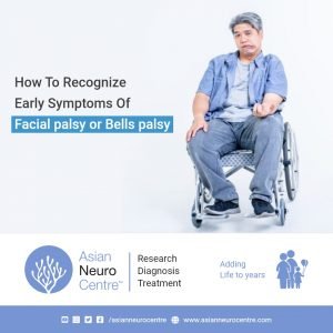 How To Recognize Early Symptoms Of Facial palsy or Bells palsy?